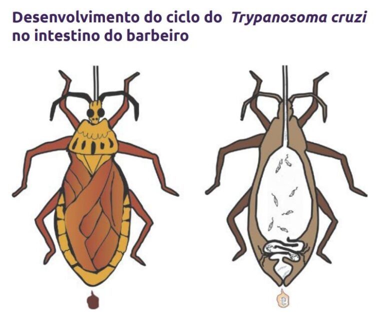 Doença de Chagas é transmissível de uma pessoa para outra - Saúde em Pauta
